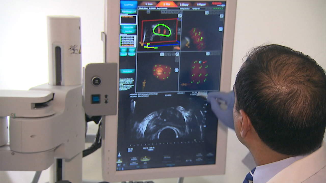 Catching prostate cancer early: simple PSA test could save your life ...